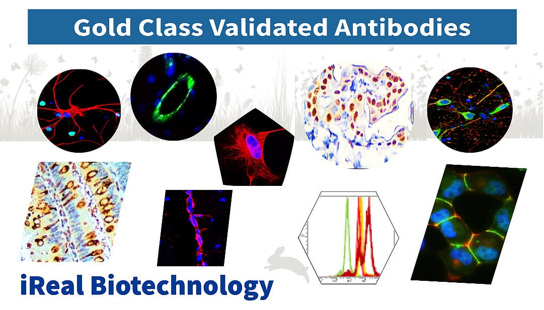 iReal Biotechnology, Inc.