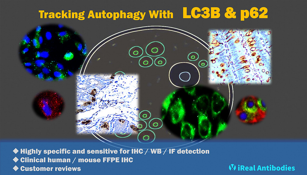 iReal Biotechnology, Inc. | iReal Biotechnology, Inc.