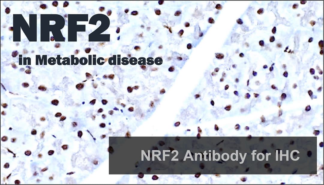A Well-Clinical IHC Nrf2 Antibody for Cellular Redox Research | iReal Biotechnology, Inc.