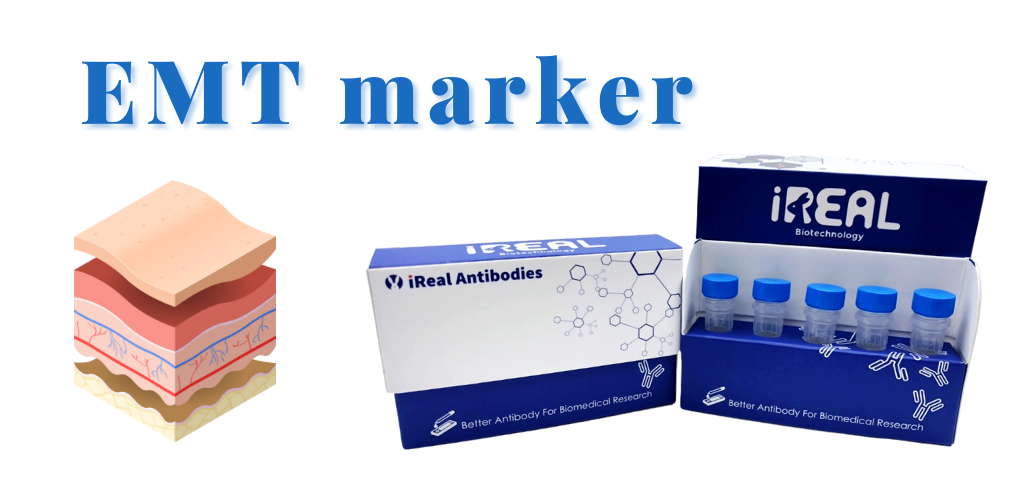 EMT Marker Antibody Panel (IRAP5001) | iReal Biotechnology, Inc.