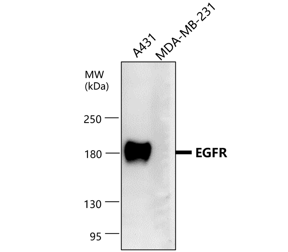 EGFR antibody (Extracellular domain) (IRST002) | iReal Biotechnology, Inc.