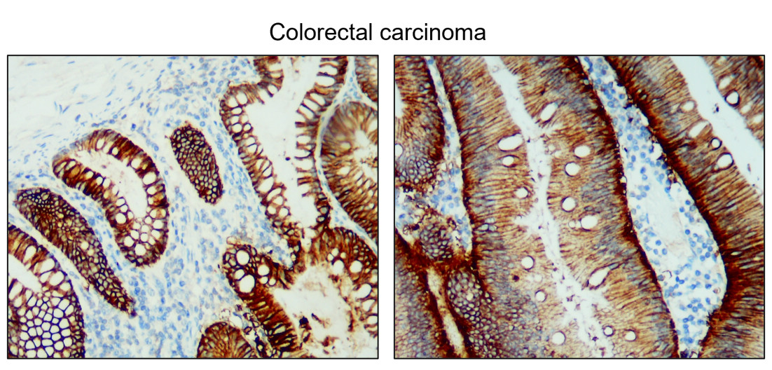 CD44 (HiLyte Fluor647 conjugated) antibody (IR208-752-F647) | iReal ...