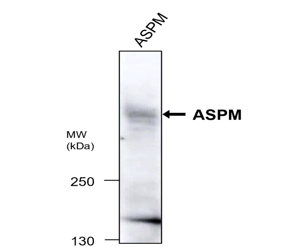 ASPM antibody (isoform1 specific) (IR353-1) | iReal Biotechnology, Inc.