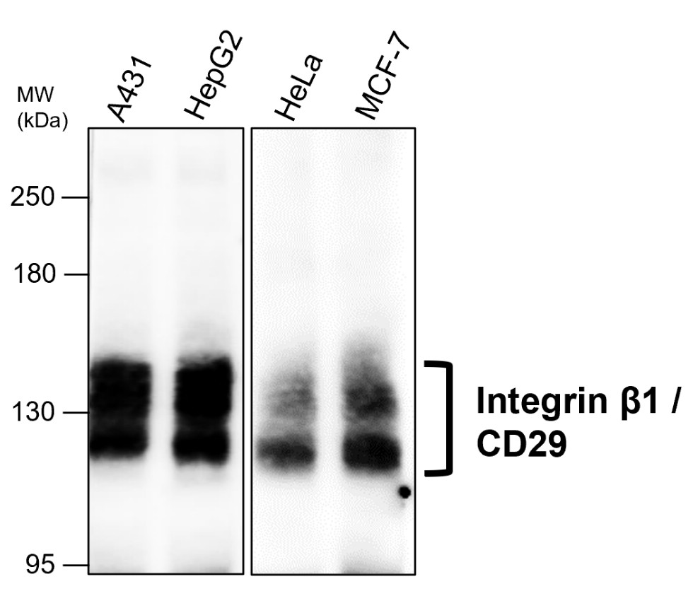 Integrin β1 / CD29 antibody [C1H1] (IRM202) | iReal Biotechnology, Inc.