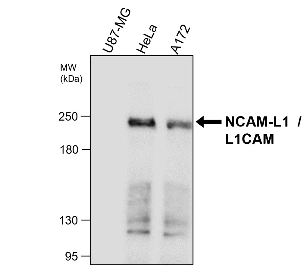 NCAM-L1 / L1CAM antibody [212A03] (IRM207) | iReal Biotechnology, Inc.