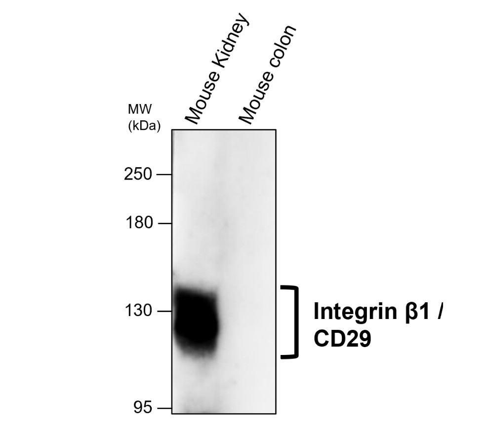 Integrin β1 / CD29 antibody [C1H1] (IRM202) | iReal Biotechnology, Inc.