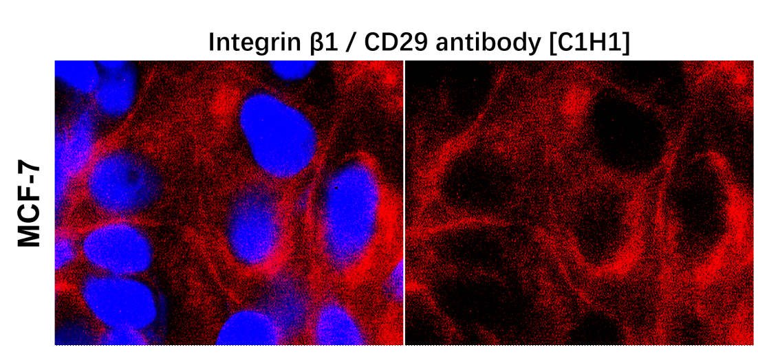 Integrin β1 / CD29 antibody [C1H1] (IRM202) | iReal Biotechnology, Inc.