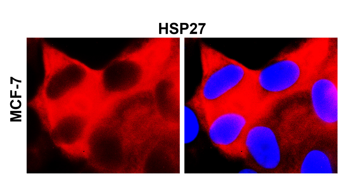 HSP27 antibody [9C2] (IRM209) | iReal Biotechnology, Inc.