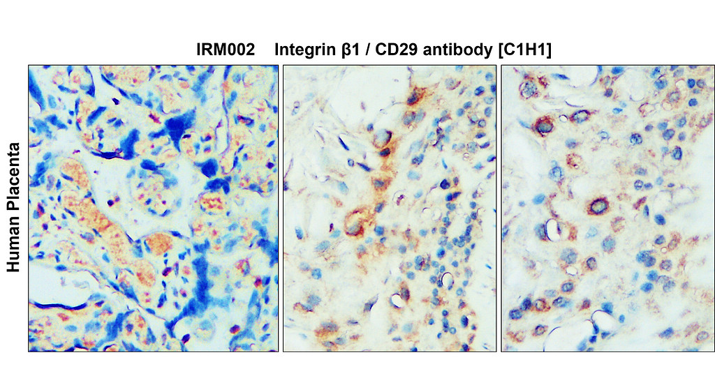 Integrin β1 / CD29 antibody [C1H1] (IRM202) | iReal Biotechnology, Inc.