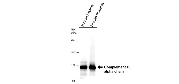 Complement C3 antibody [15A10] (IRM211) | iReal Biotechnology, Inc.