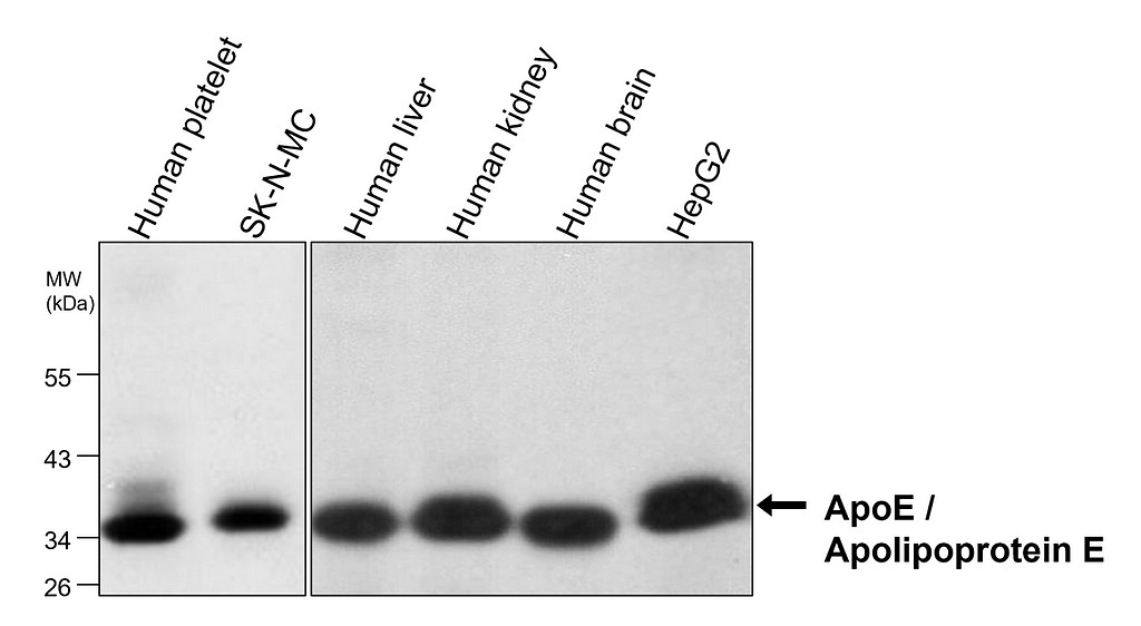 ApoE / Apolipoprotein E monoclonal antibody (IRM012) | iReal ...