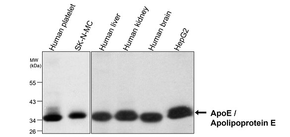 ApoE / Apolipoprotein E monoclonal antibody (IRM012) | iReal Biotechnology, Inc.
