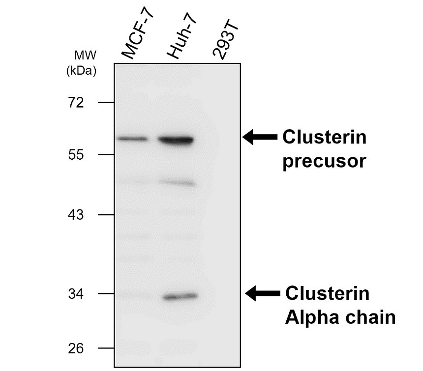 Clusterin antibody [10F7] (IRM212-草稿2024/12/09) | iReal Biotechnology, Inc.