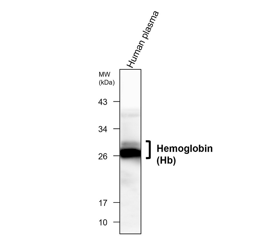 Hemoglobin (Hb), monoclonal antibody [23D] (IRM016) | iReal ...