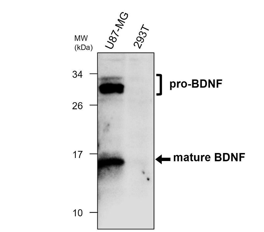 BDNF antibody [PA-1] (IRM301-草稿2024/12/09) | iReal Biotechnology, Inc.