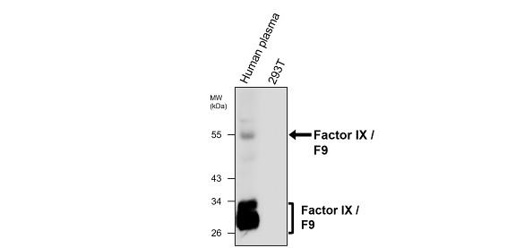 Factor IX / F9 antibody [PB-3] (IRM311) | iReal Biotechnology, Inc.