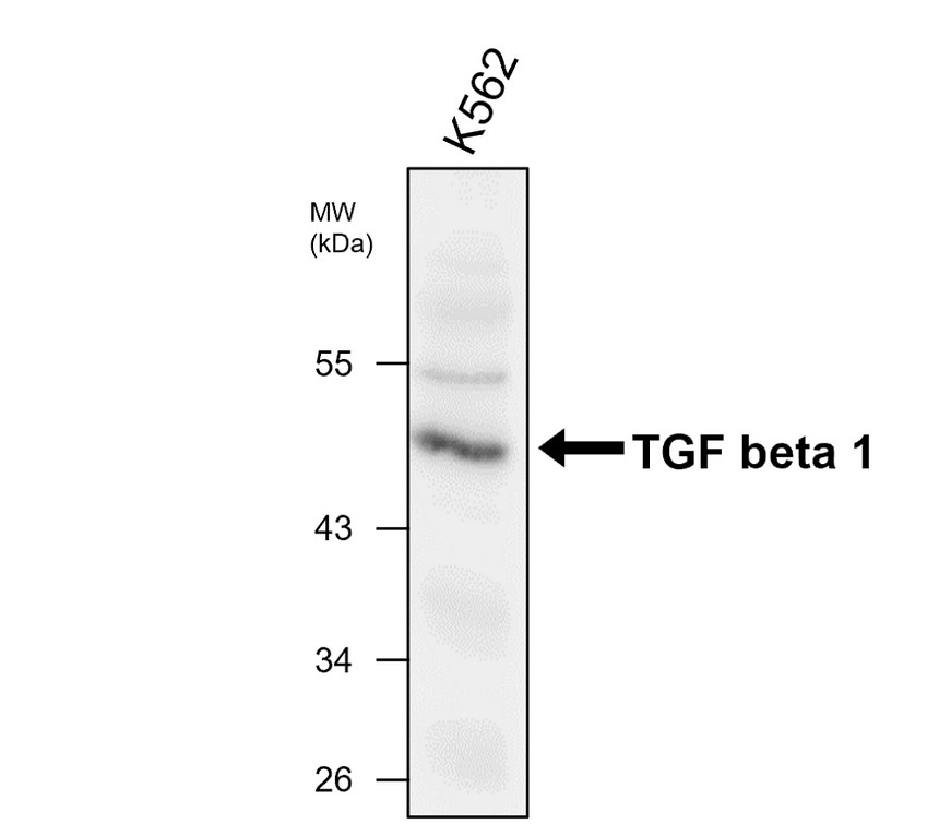 TGF-beta 1 antibody [PC-4] (IRM312-草稿2024/12/09) | iReal Biotechnology ...