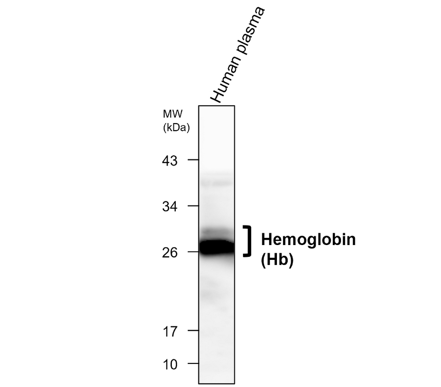 Hemoglobin (Hb) Detection monoclonal antibody [23F] (IRM018) | iReal ...