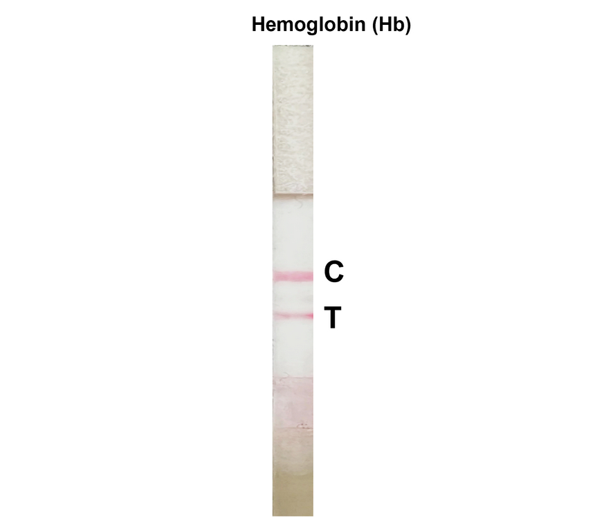 Hemoglobin (Hb) Detection monoclonal antibody [23F] (IRM018) | iReal ...