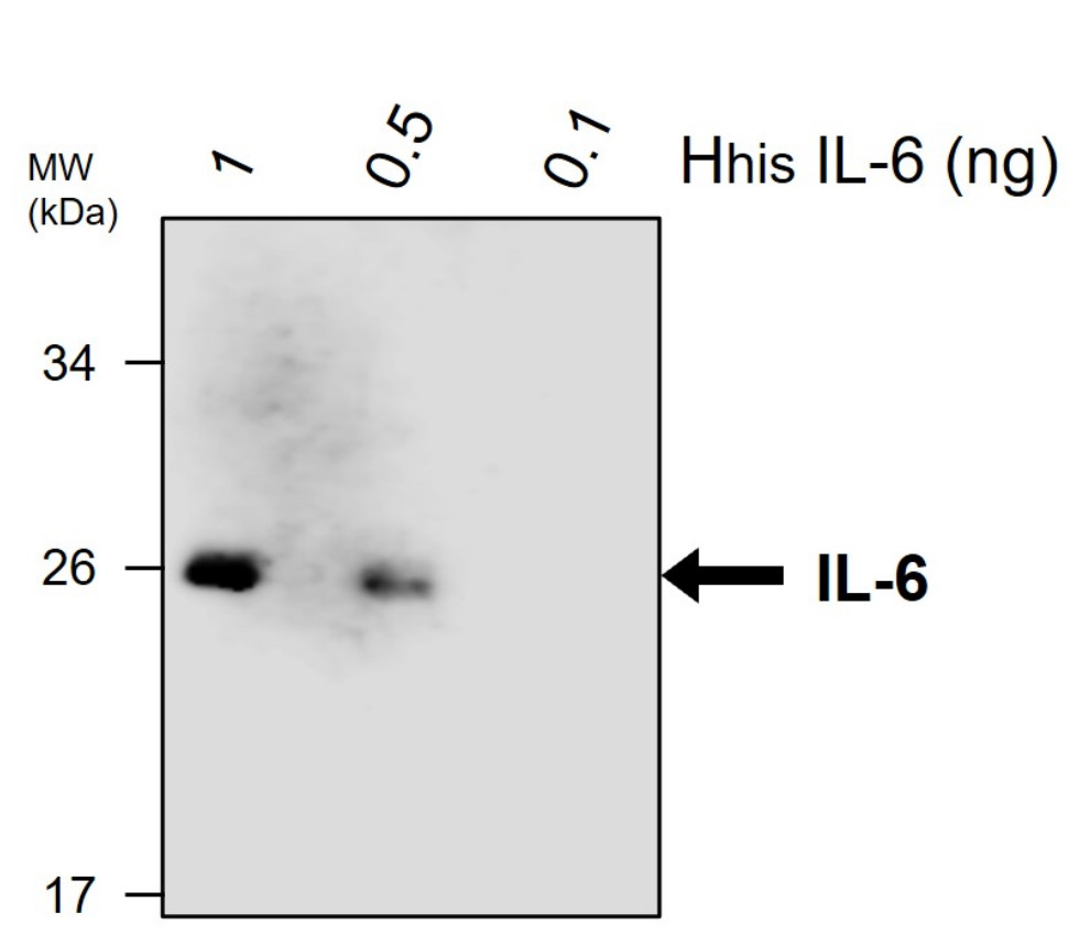 IL6 antibody [M507] (IRM318-草稿2024/12/09) | iReal Biotechnology, Inc.