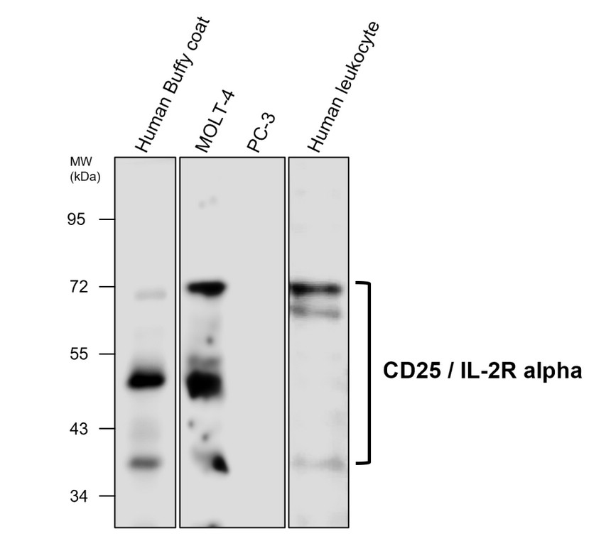 CD25 / IL-2R alpha antibody [M431] (IRM316-草稿2024/12/09) | iReal ...