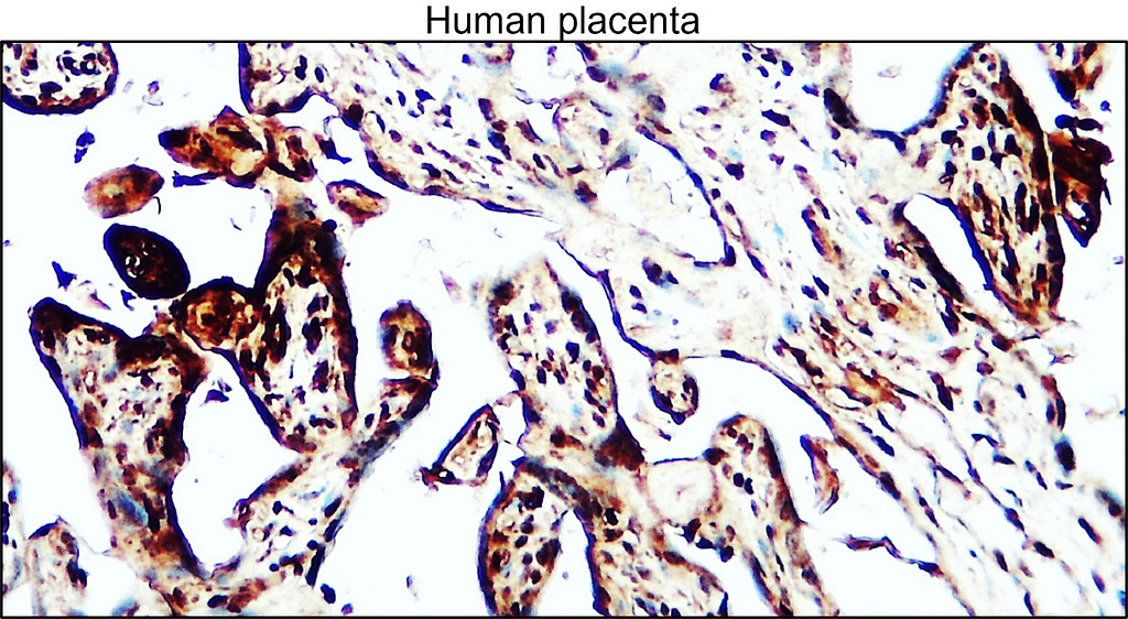 MCP-1 / MCAF antibody [PD-5] (IRM313) | iReal Biotechnology, Inc.