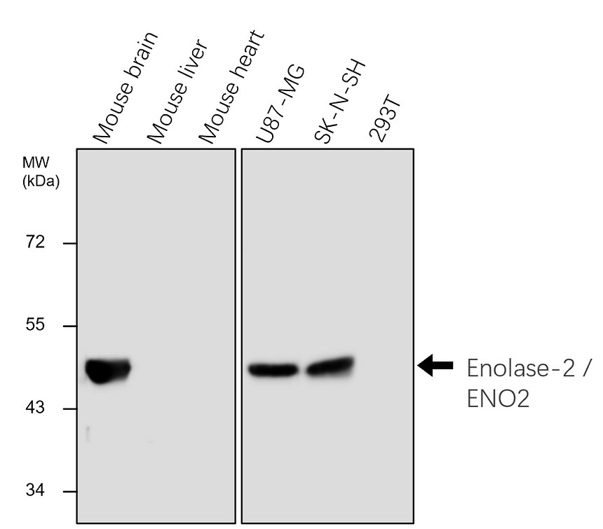 NSE / Enolase-2 antibody (IR31-90) | iReal Biotechnology, Inc.