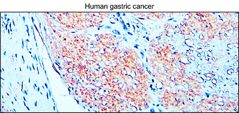 Carbonic Anhydrase IX / CA-IX antibody (IR111-456) | iReal ...