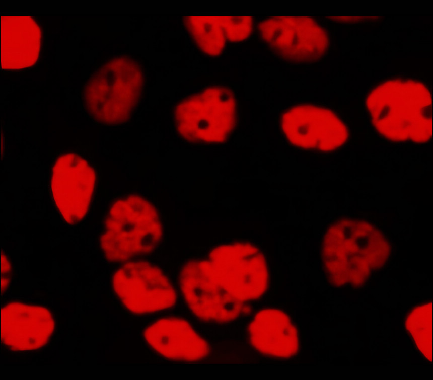 Mouse anti-rabbit IgG, APC Conjugated (IRFS4142) | iReal Biotechnology ...