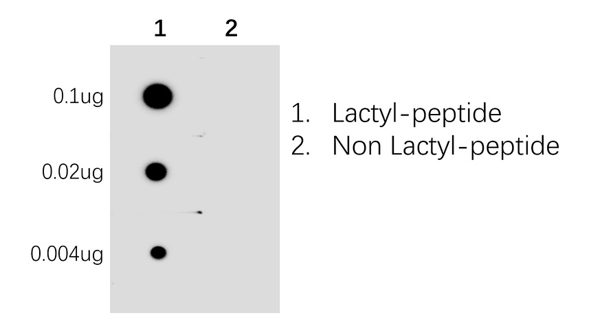 Lactyl Vimentin (K139La) antibody (IRCP2307A2) | iReal Biotechnology, Inc.