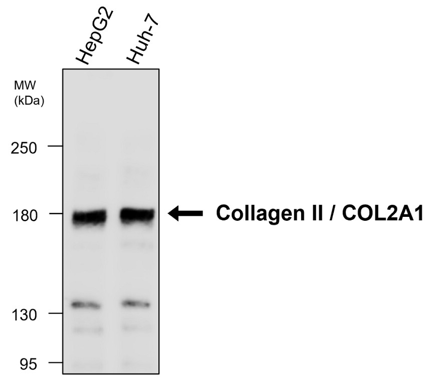 Collagen II / COL2A1 antibody (IR296-1) | iReal Biotechnology, Inc.