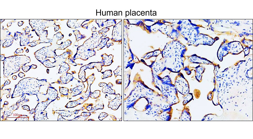 Nectin-4 / PVRL4 antibody (IR283-P1) | iReal Biotechnology, Inc.